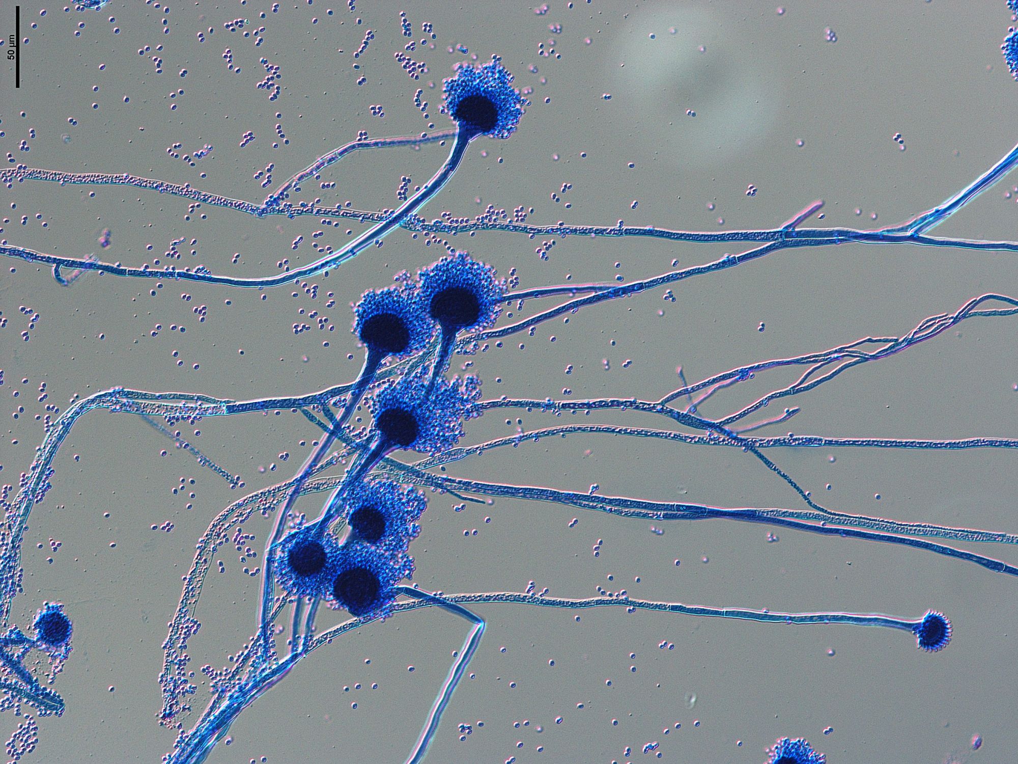Aspergillus fumigatus pan-genome analysis identifies genetic variants ...